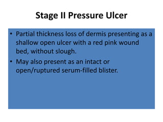 pressure ulcers model.pptx by dr amna hassan | PPTX