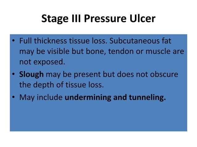 pressure ulcers model.pptx by dr amna hassan | PPTX