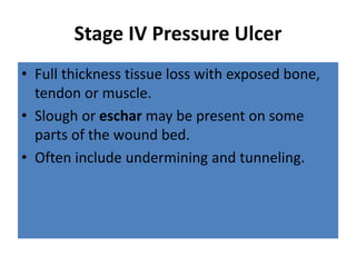 pressure ulcers model.pptx by dr amna hassan | PPTX