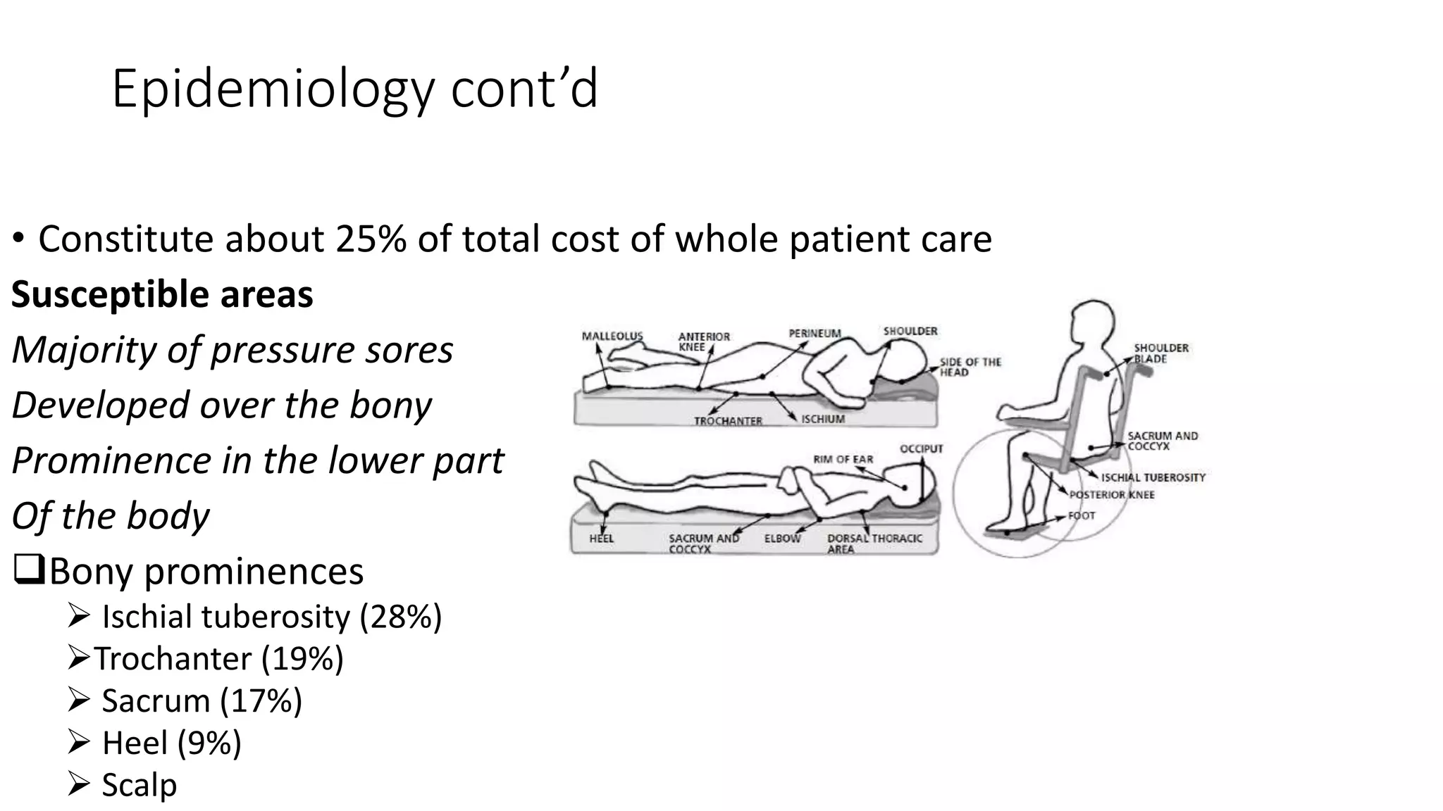 Pressure Ulcers- Pathology and Management | PPTX