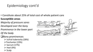 Pressure Ulcers- Pathology and Management | PPTX