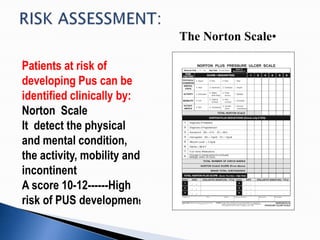 Pressure ulcers presentation | PPSX