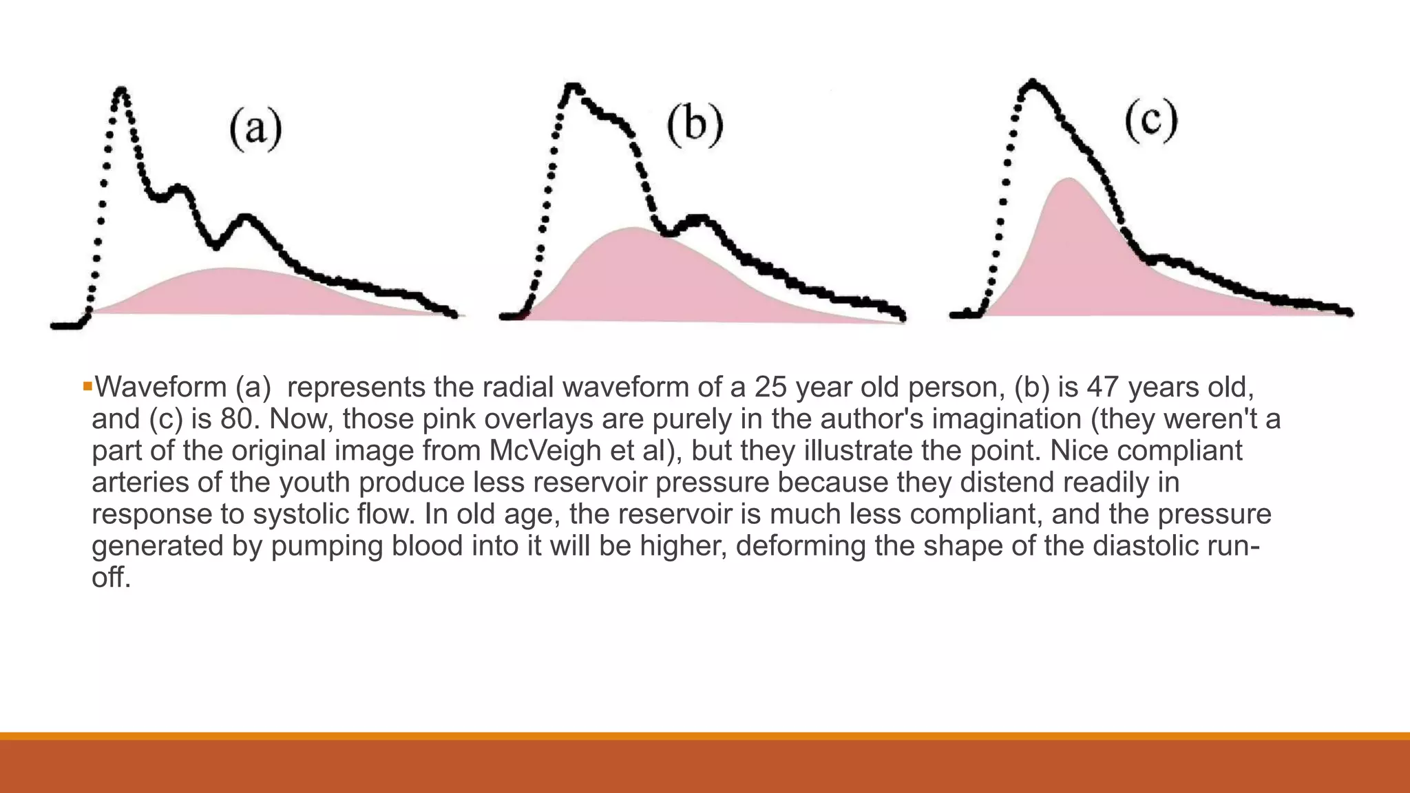 Pressure wave forms | PPTX