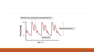 Pressure wave forms | PPTX