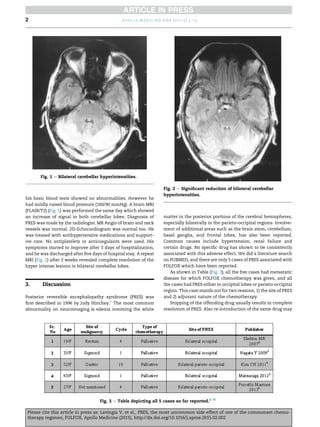 PRES, the most uncommon side effect of one of the commonest ...