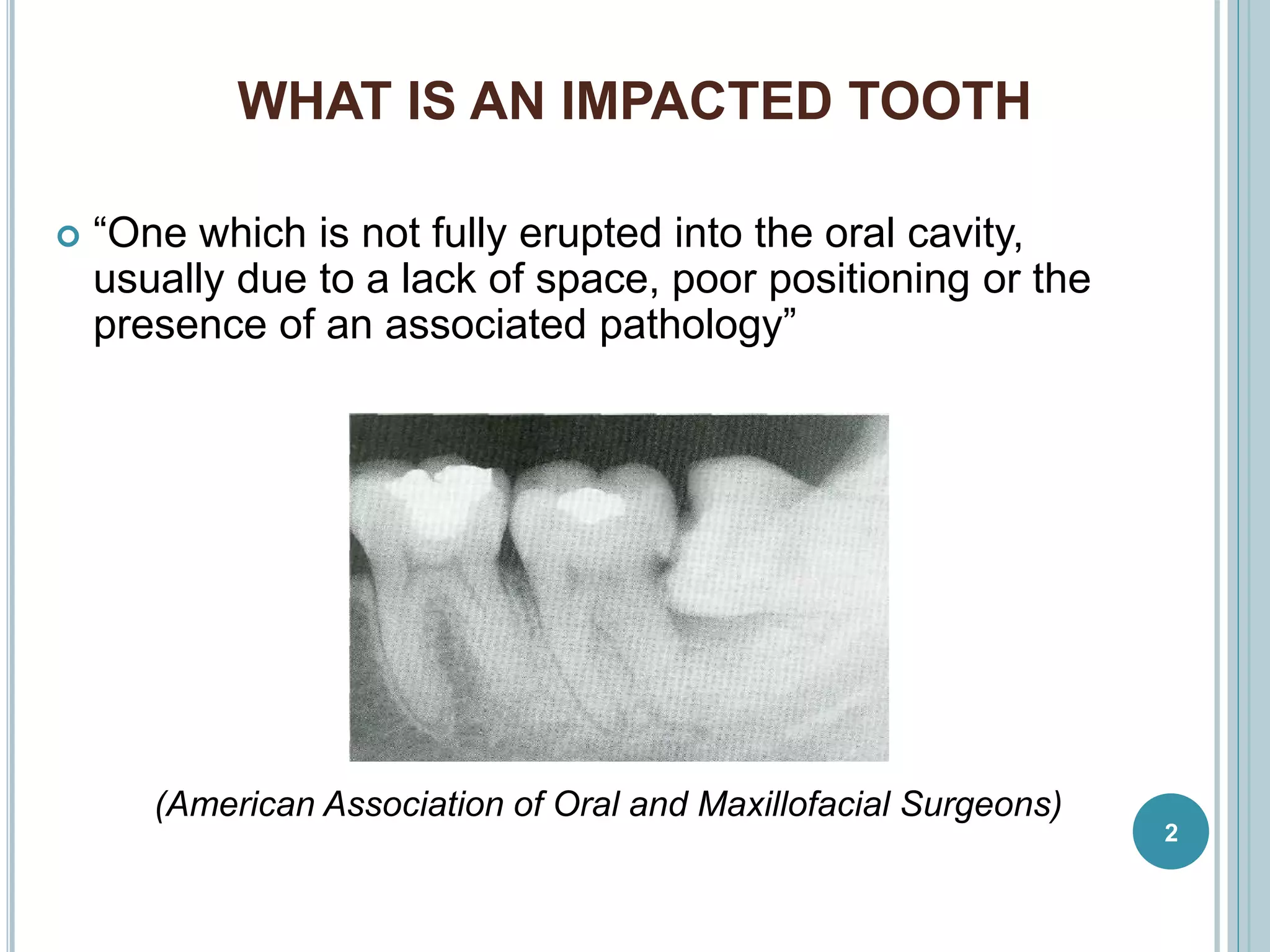 Presurgical Assessment of Impacted Molar Tooth | PPTX
