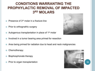 Presurgical Assessment of Impacted Molar Tooth | PPTX