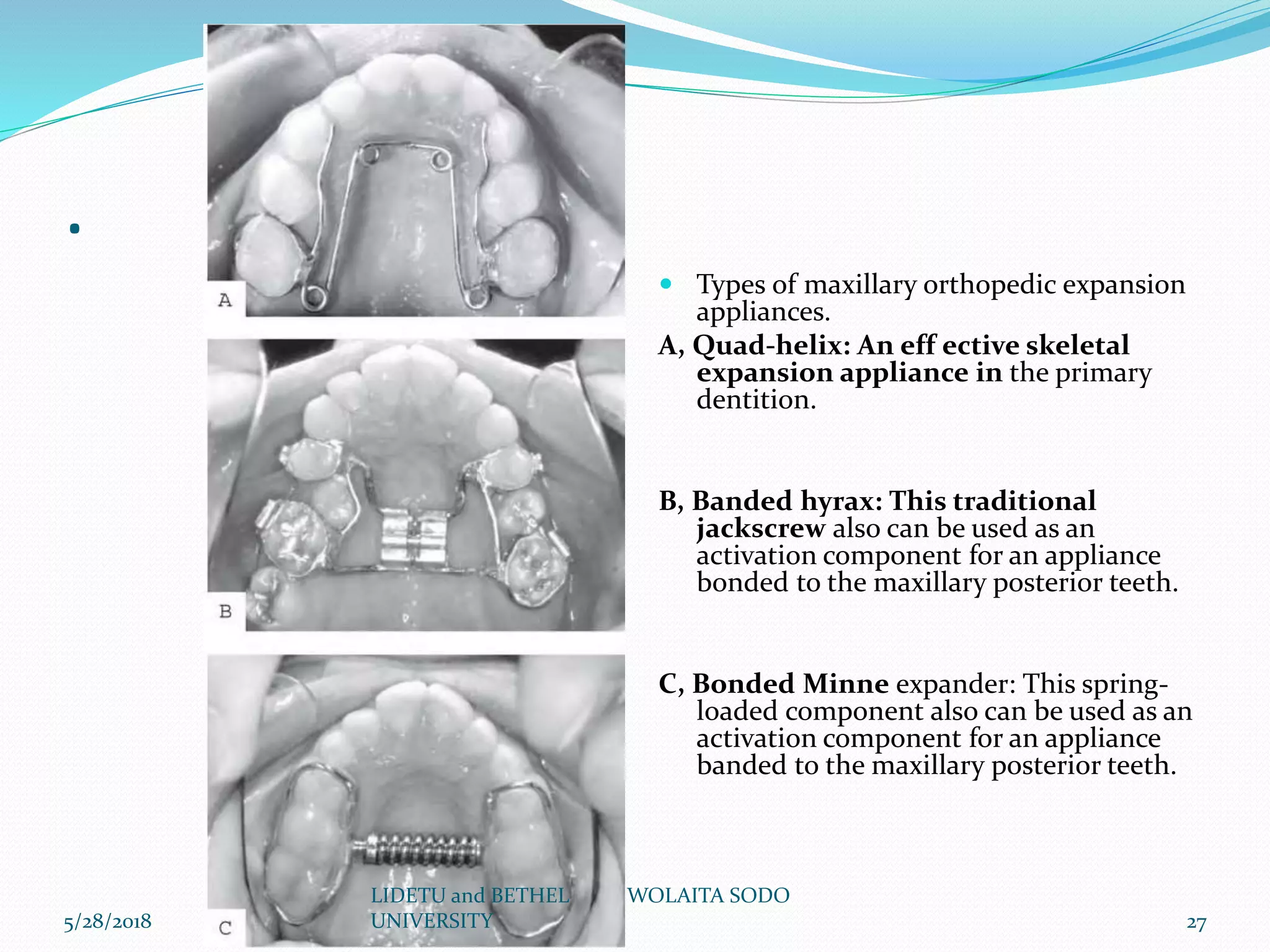 Presurgical diagnosis and treatment planing of orthognathic surgery, Dr ...
