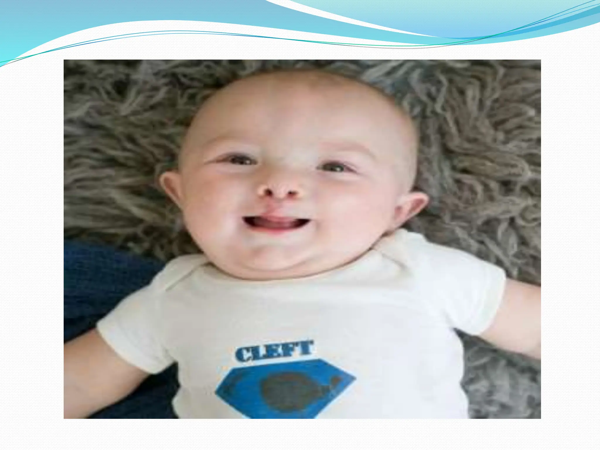 Pre surgical orthopedics in cleft patients .pptx
