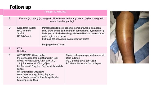 Presentasi kasus Kejang Demam Simplex selulitis.pptx