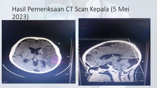 PRESUS SNH Radiologi.pptx
