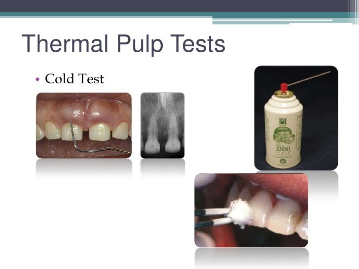 Pret 7326 nat boardreview 2012