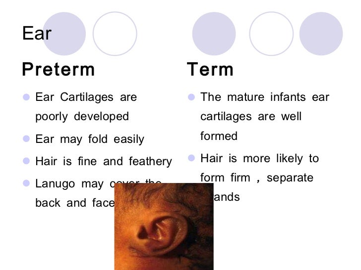 Preterm Preterm