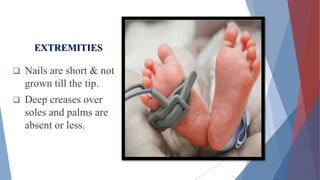 PRETERM.............................pptx