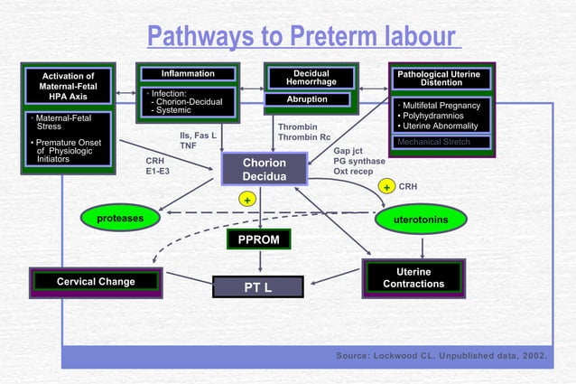Preterm Labour and Premature Rupture of Membranes Mob: 7289915430, www ...
