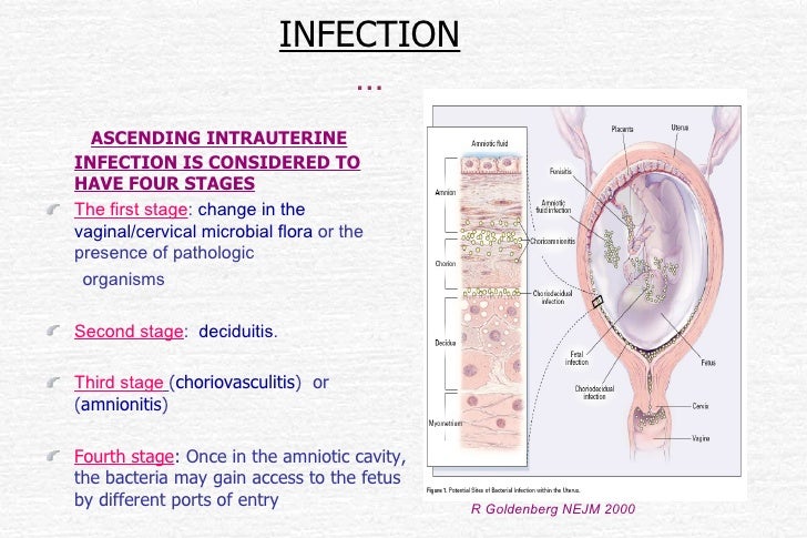 Preterm Labour and Premature Rupture of Membranes Mob: 7289915430, ww…