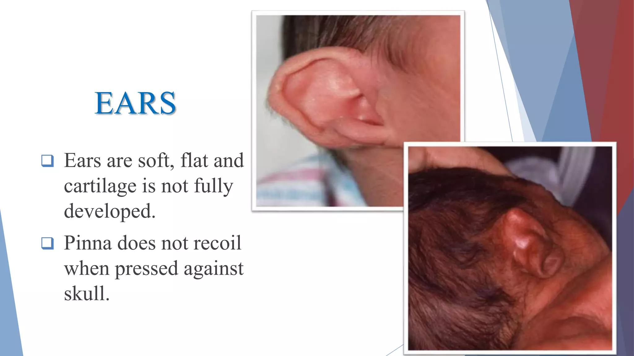 Preterm Neonate | PPTX