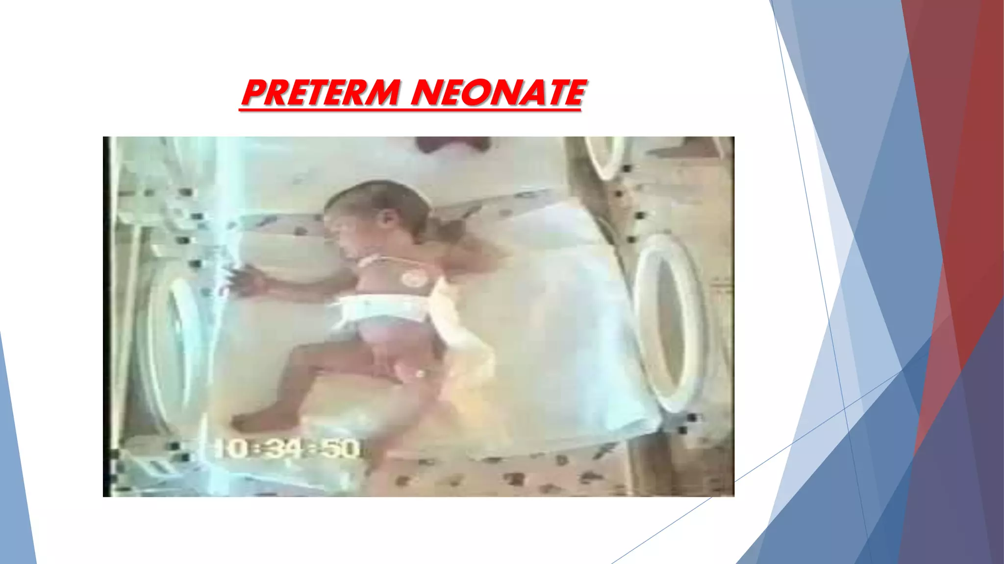 Preterm Neonate | PPTX