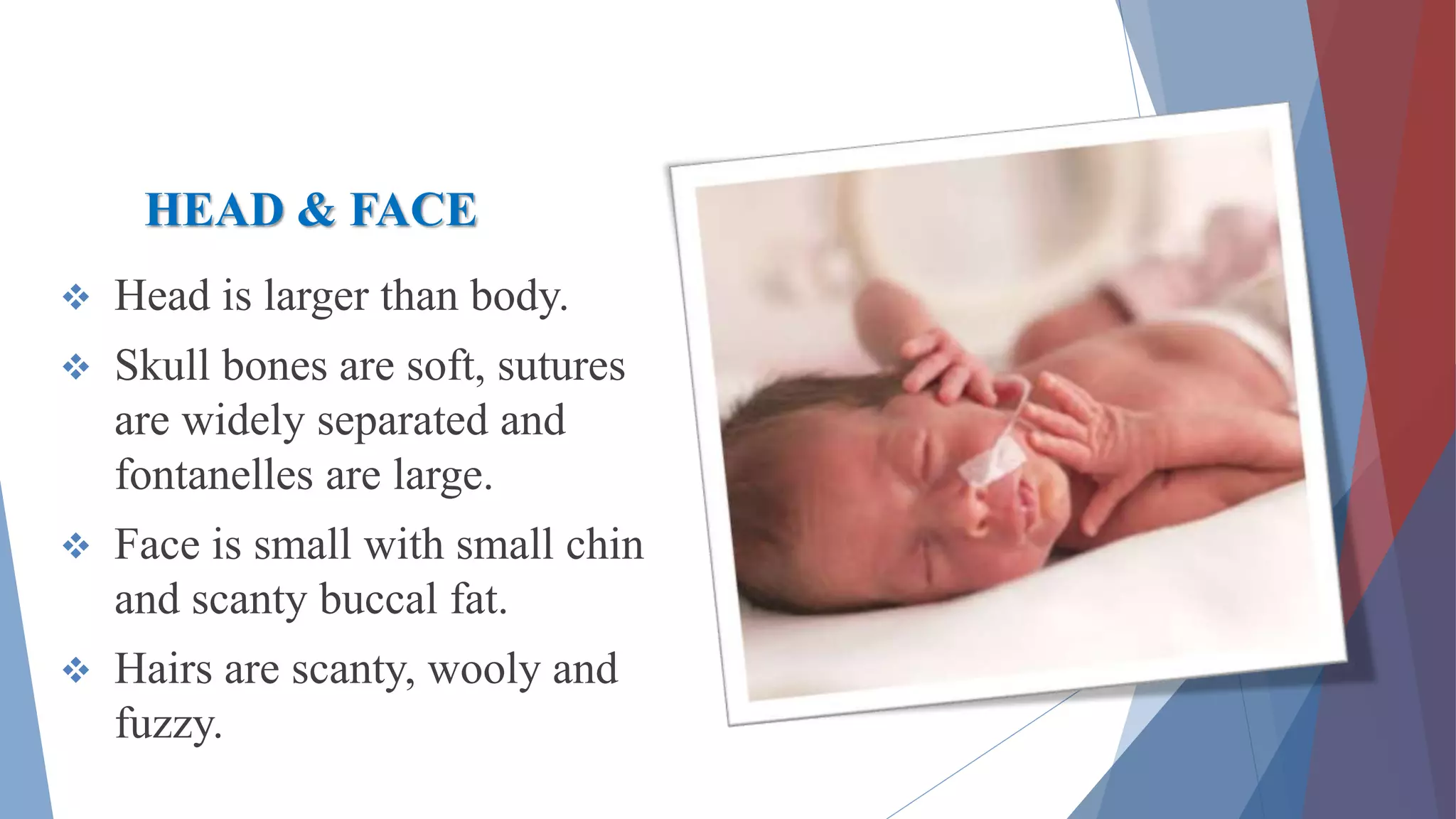 Preterm Neonate | PPTX