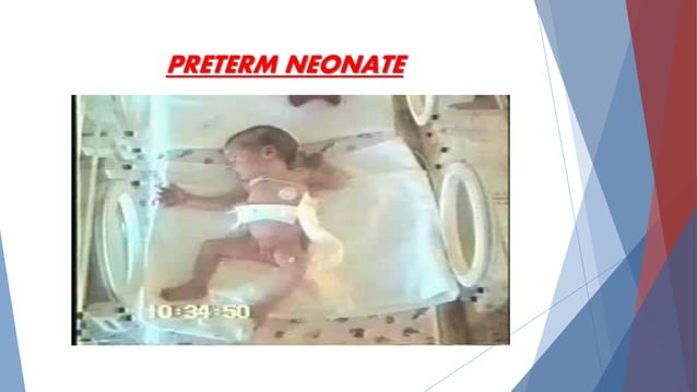 Preterm Neonate | PPTX | Pregnancy | Reproductive Health
