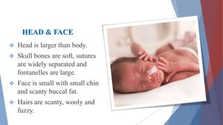 Preterm Neonate | PPTX
