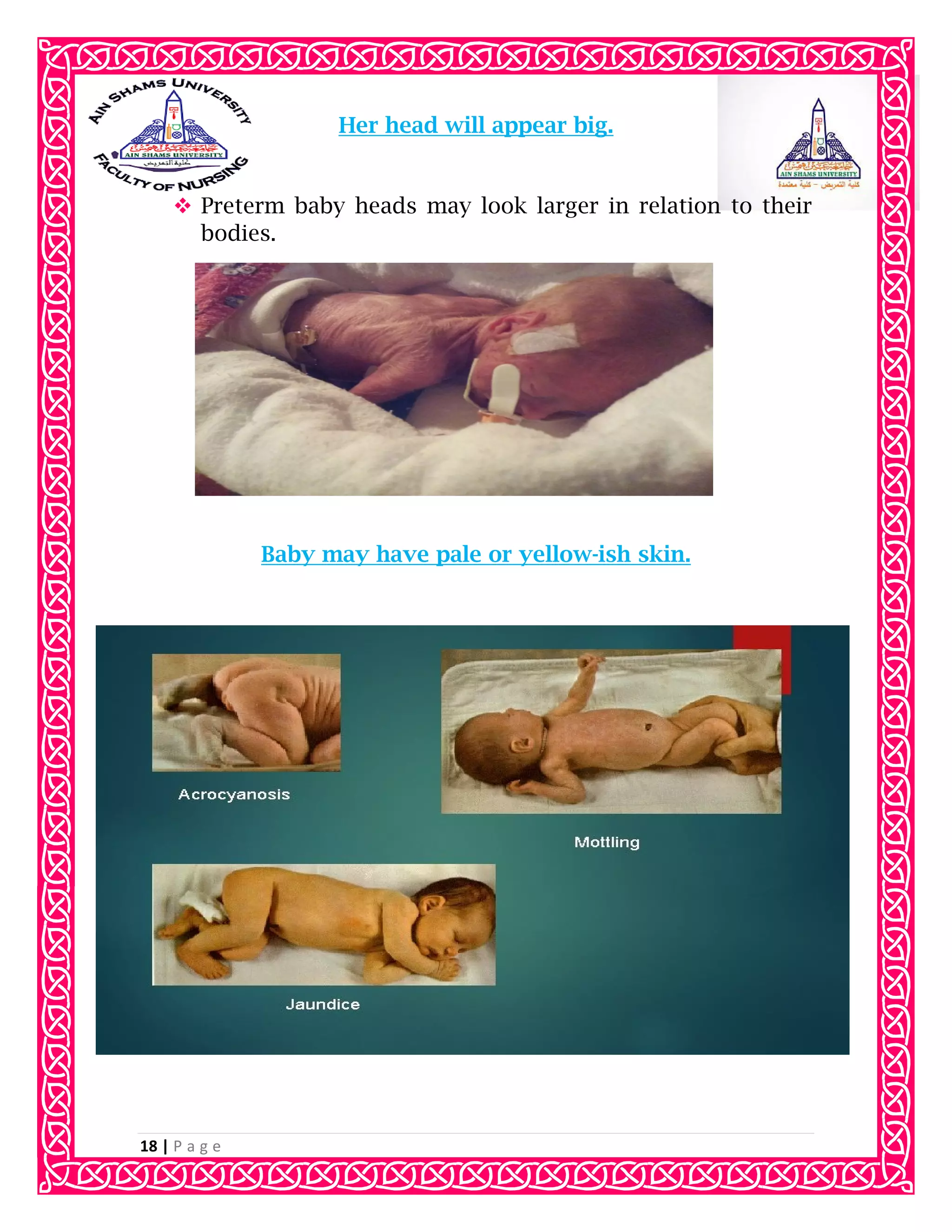 preterm baby.pdf