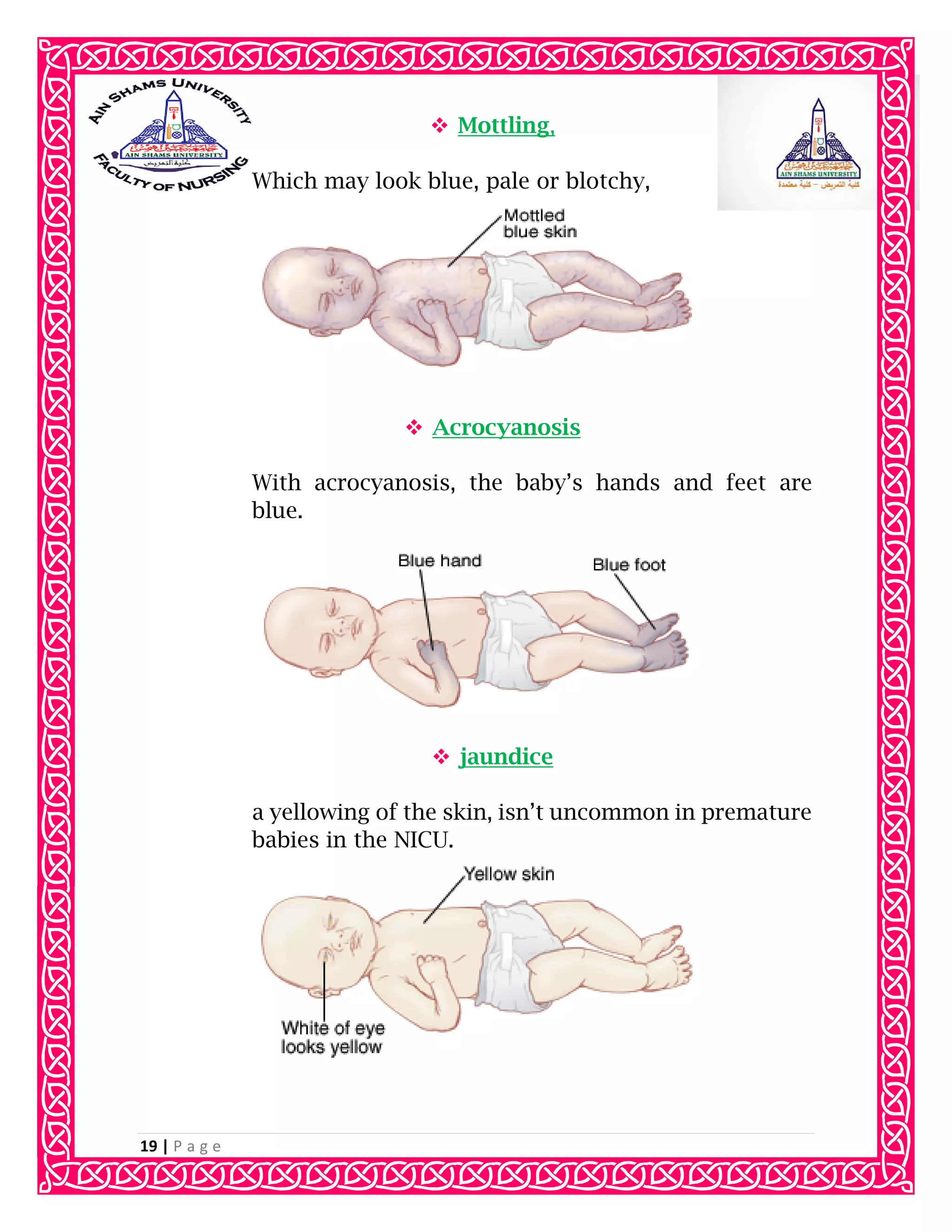preterm baby.pdf