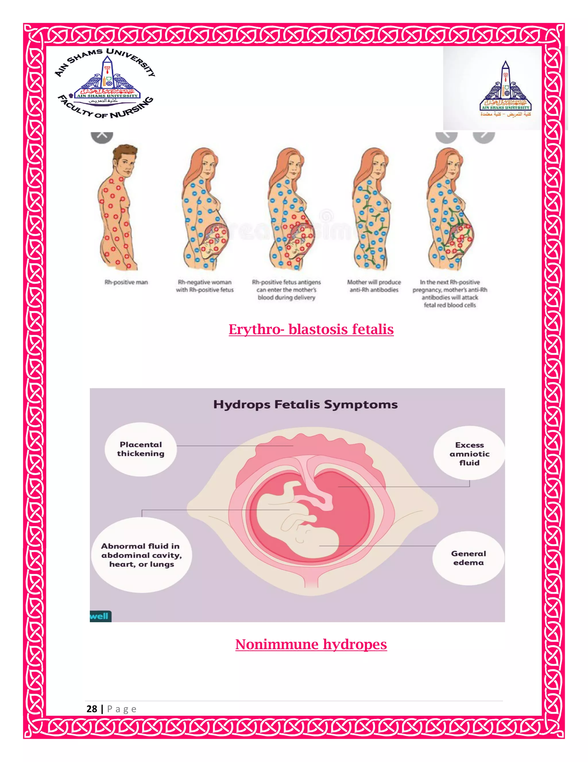preterm baby.pdf