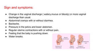 Preterm labor.pptx