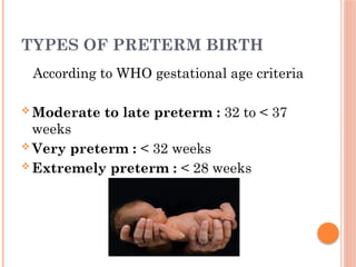 preterm labor( p) - powerpoint presentation | PPTX