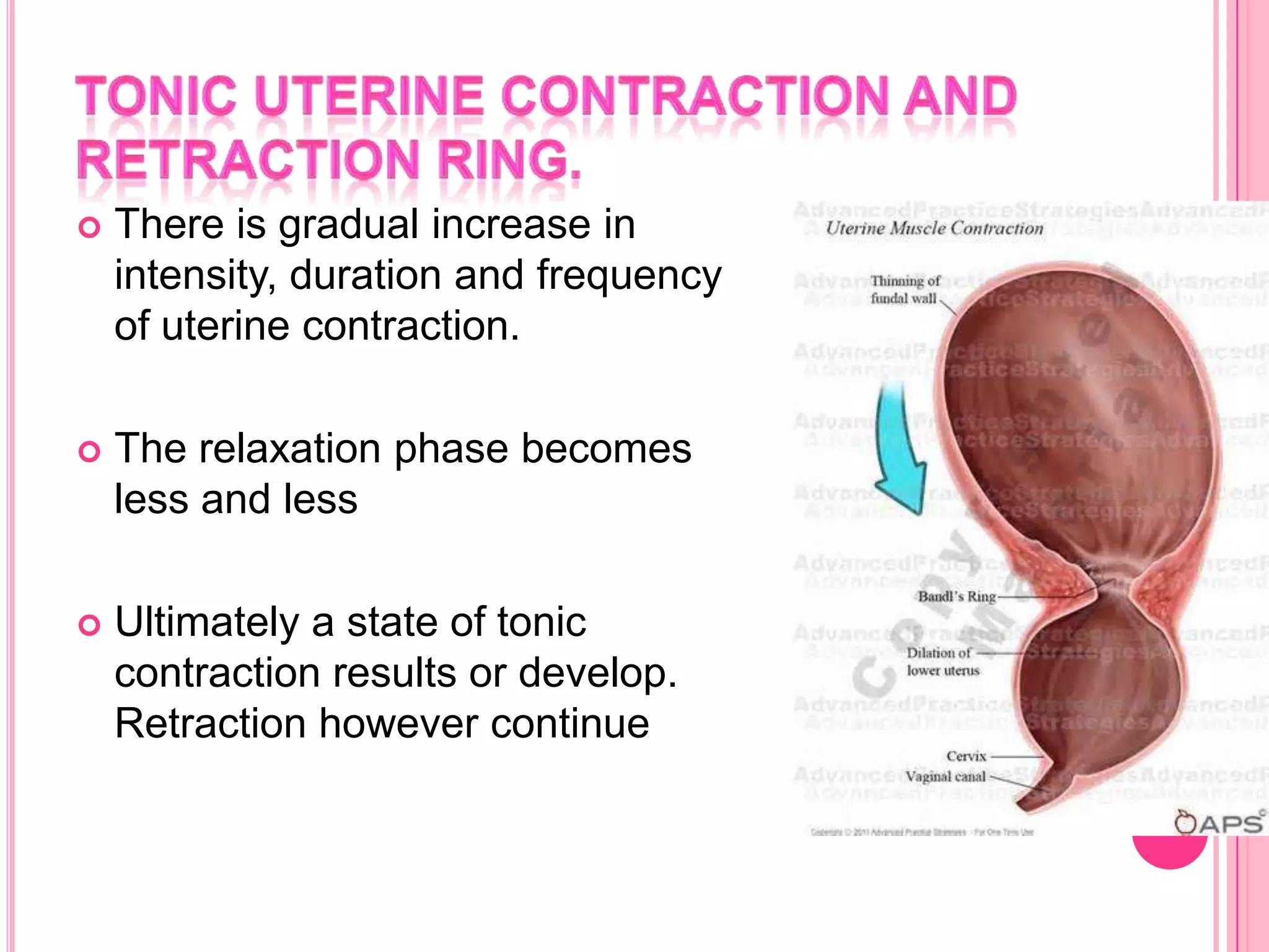Preterm labour | PPTX