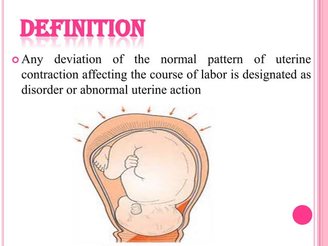 Preterm labour | PPTX | Pregnancy | Reproductive Health