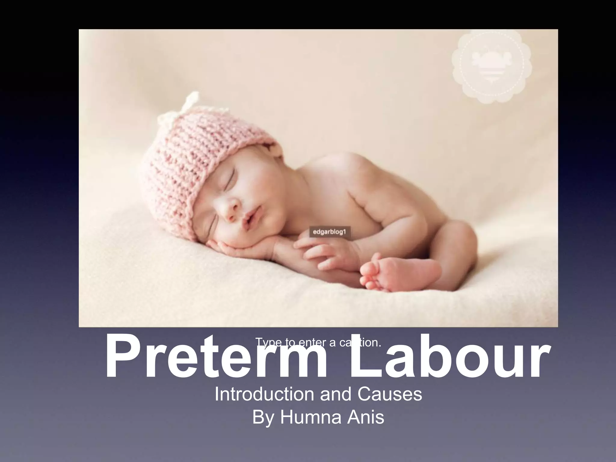 Preterm labour | PPTX