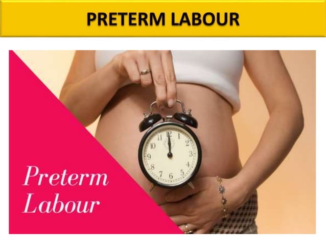 PRETERM LABOUR | PPTX