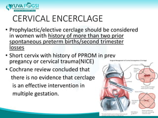 PRETERM LABOUR | PPT