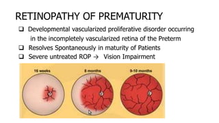 Preterm neonates & complications | PPTX