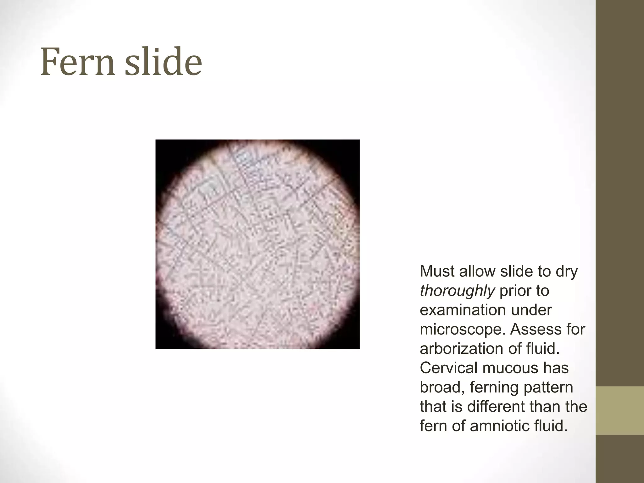 Preterm Rupture of Membranes.ppt