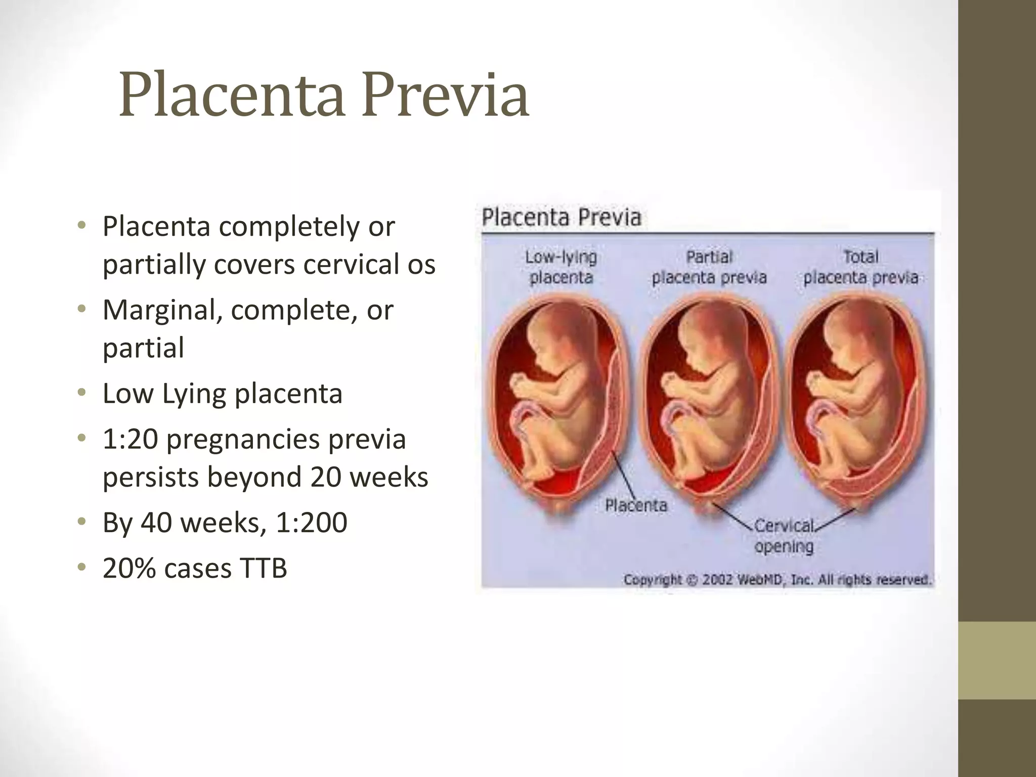 Preterm Rupture of Membranes.ppt
