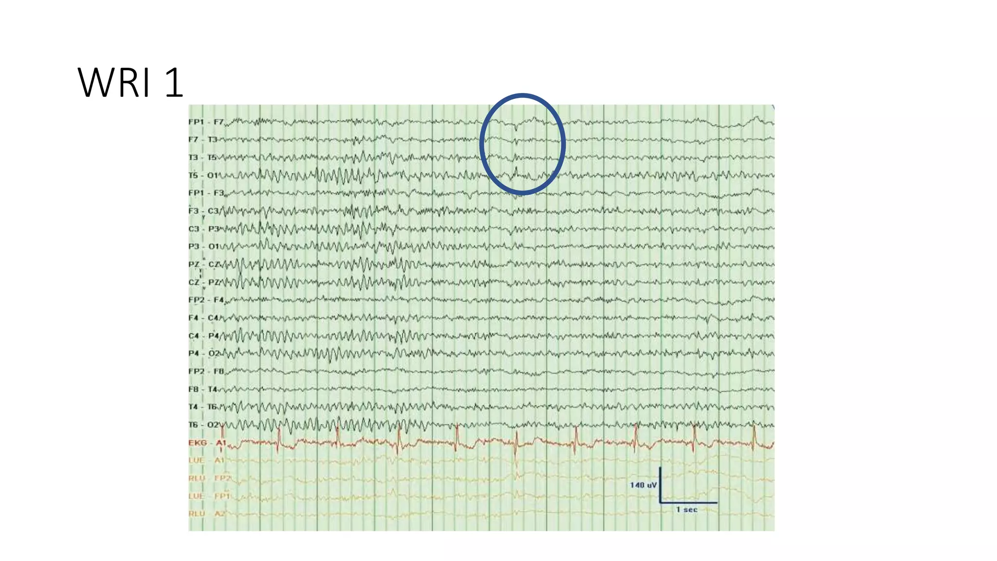 pretest post test.pptx