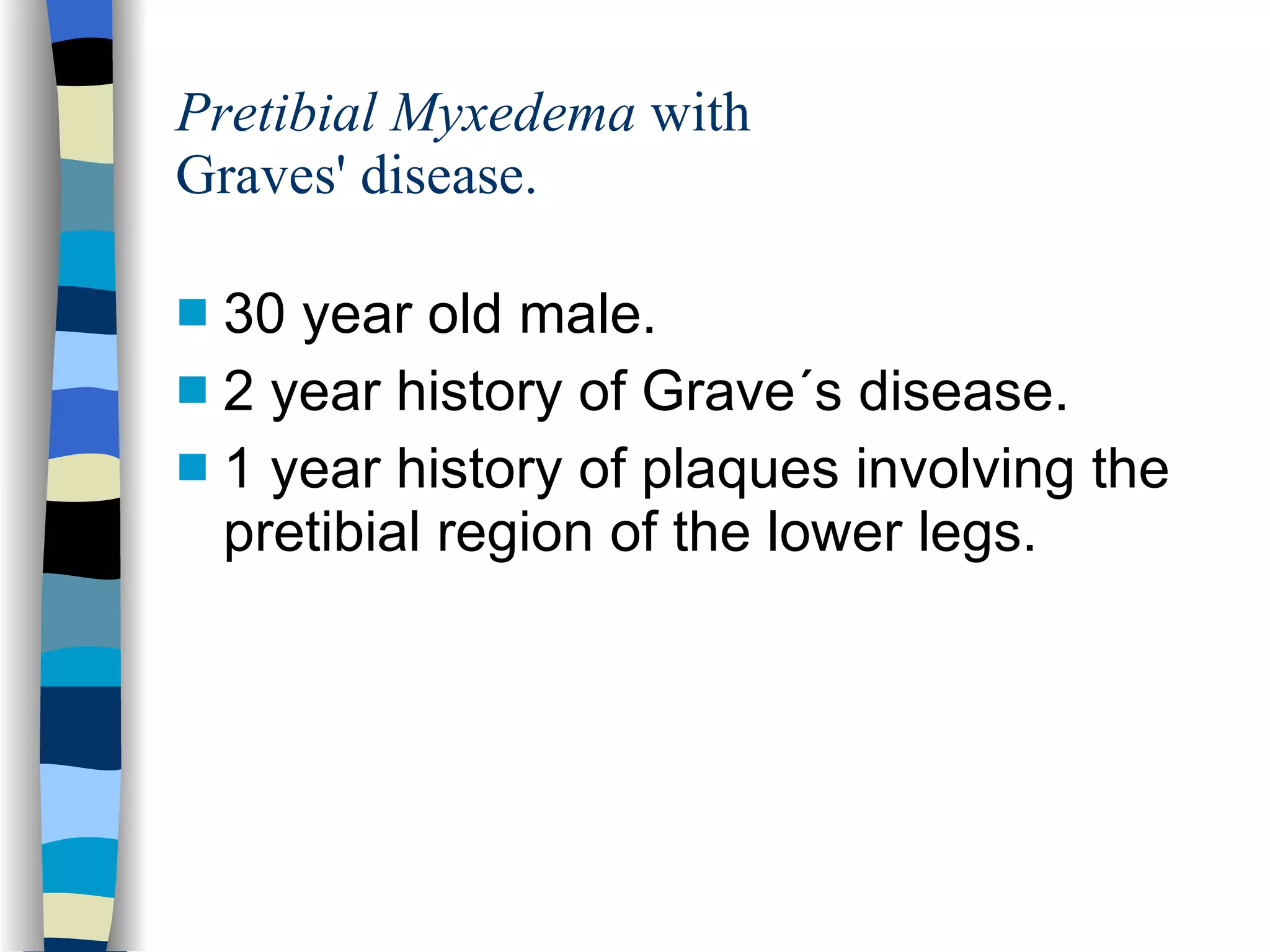 Pretibial myxedema wiyh graves disease[1]. | PPT