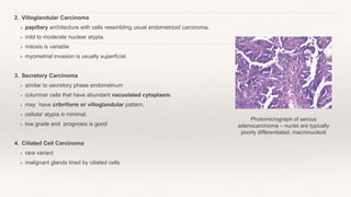 Pre treatment work-up of carcinoma endometrium | PPTX