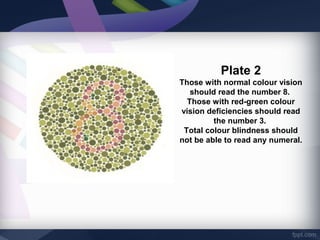 Prevalence of red green color vision defects | PPT