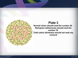 Prevalence of red green color vision defects | PPT