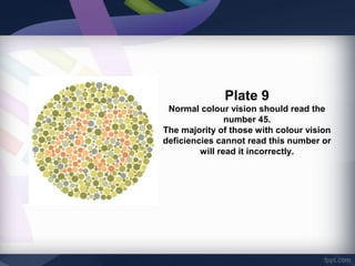 Prevalence of red green color vision defects | PPT