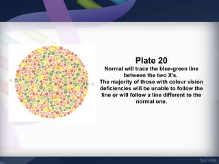 Prevalence of red green color vision defects | PPT
