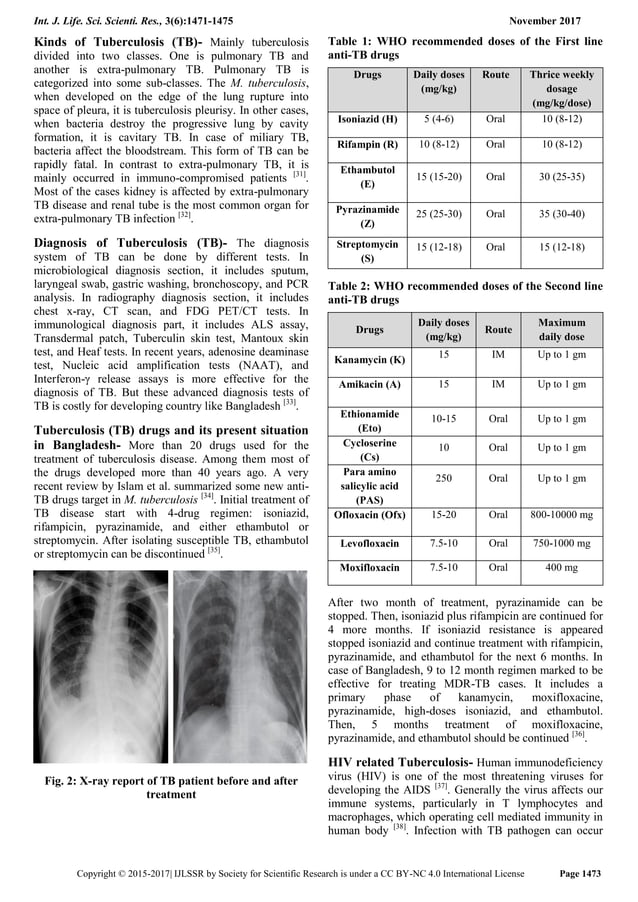 Prevalence of Tuberculosis: Present Status and Overview of Its Control ...