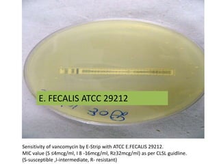 Prevalence of vancomycin resistant enterococcal species (vre) in ...