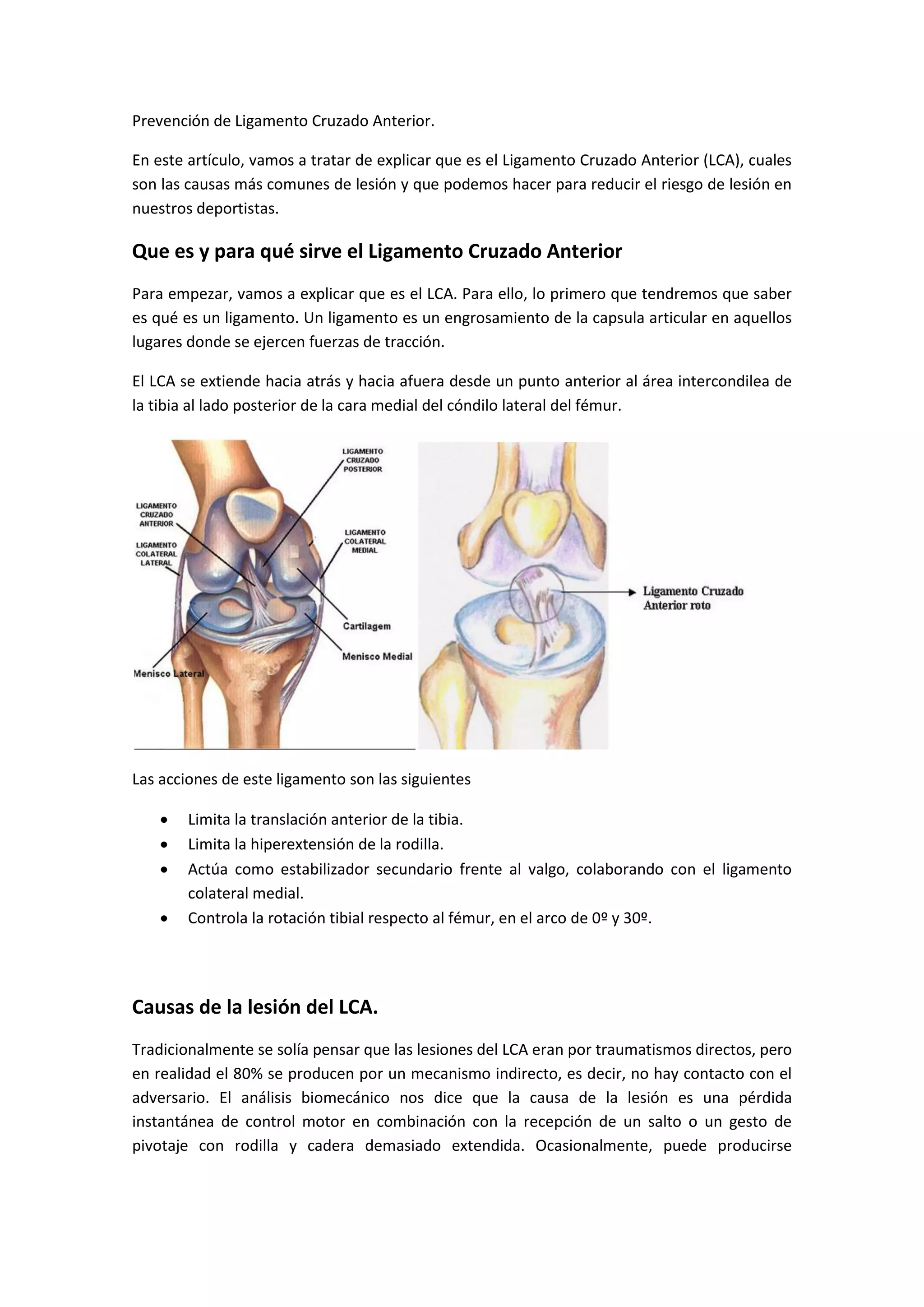 Prevención de ligamento cruzado anterior articulo base | PDF