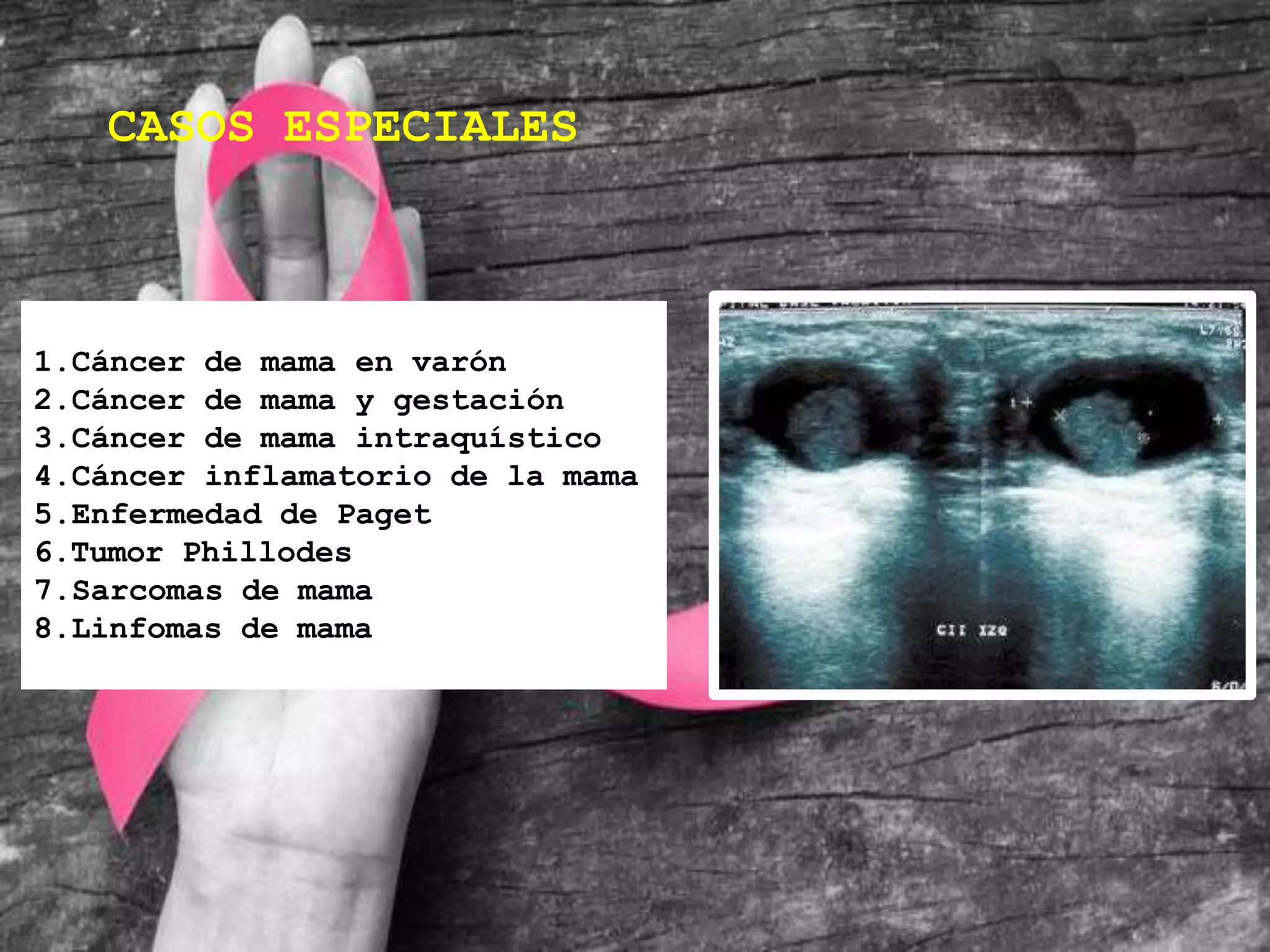 PREVENCION CANCER DE MAMA.pptx