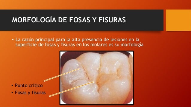 Prevencion en odontopediatria inn